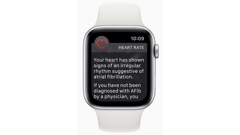 Apple Watch không thể phát hiện AFib ở nhịp tim trên 120bpm