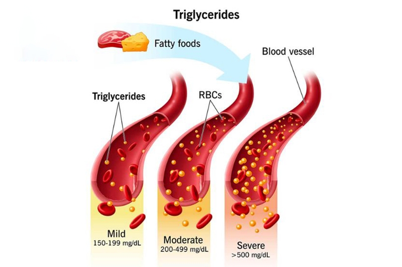 Chỉ số Triglyceride là gì? Hiểu rõ về chất béo trung tính và ý nghĩa ...