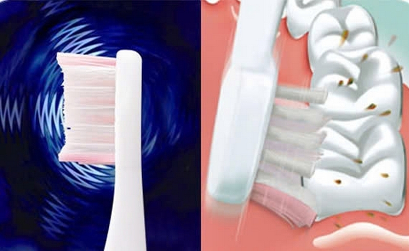 Bot đánh răng là gì? Top những thương hiệu bot đánh răng tốt nhất hiện nay